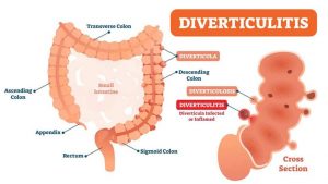 Facts about Pain in Left Side of Belly Button – Entirely Health