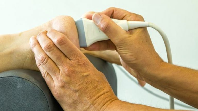 What is Gout? Common Facts to Know – Page 4 – Entirely Health