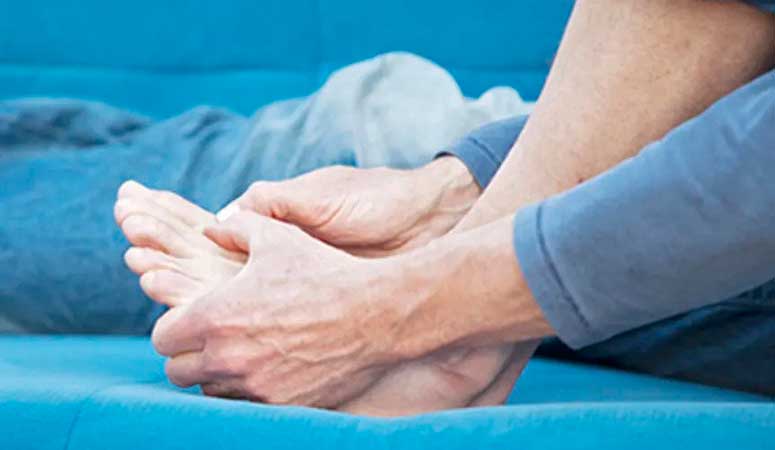 Some Facts That You Should Know Are about Gout (Gouty Arthritis) – Page ...