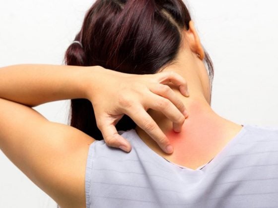 What is Scabies? – Signs And Symptoms – Entirely Health