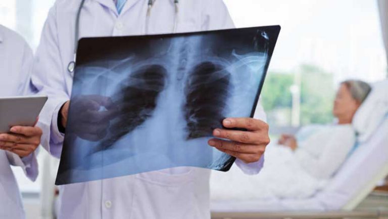 Chronic Bronchitis Fact Sheet – Page 2 – Entirely Health