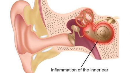 Signs And Symptoms of Inner Ear Infection – Entirely Health