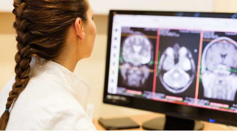 Early Warning Signs of a Brain Aneurysm – Entirely Health