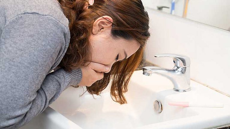 Early Warning Signs of a Brain Aneurysm – Page 4 – Entirely Health