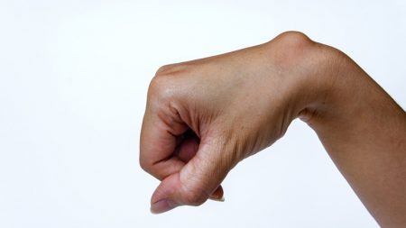 Hard Lump under Skin: 8 Causes and How They Are Treated – Entirely Health
