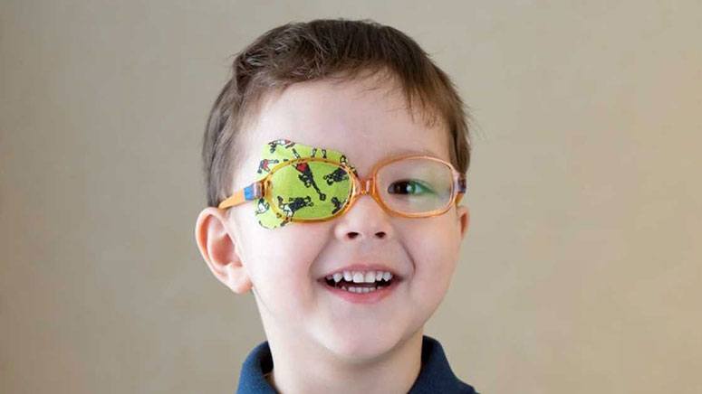 Lazy Eye (Amblyopia): Symptoms, Causes, and Treatment – Page 2 ...