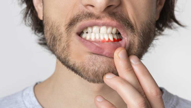 10 Common Remedies for a Tooth Infection – Page 3 – Entirely Health