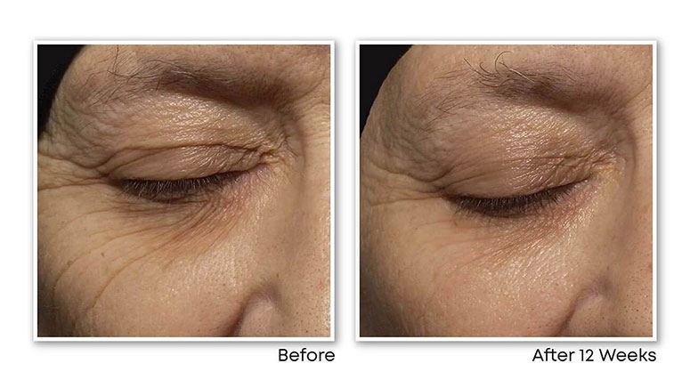 How Does Retinol Work for Skin? Common Facts to Know – Page 4 ...