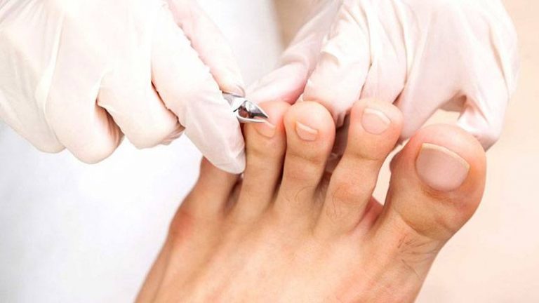 Toenail Growth – How Long It Takes for a Toenail to Grow Back ...