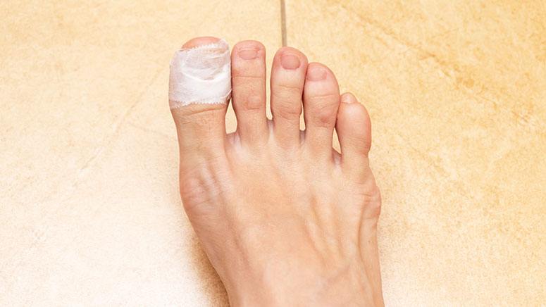 Toenail Growth – How Long It Takes for a Toenail to Grow Back – Page 4 ...