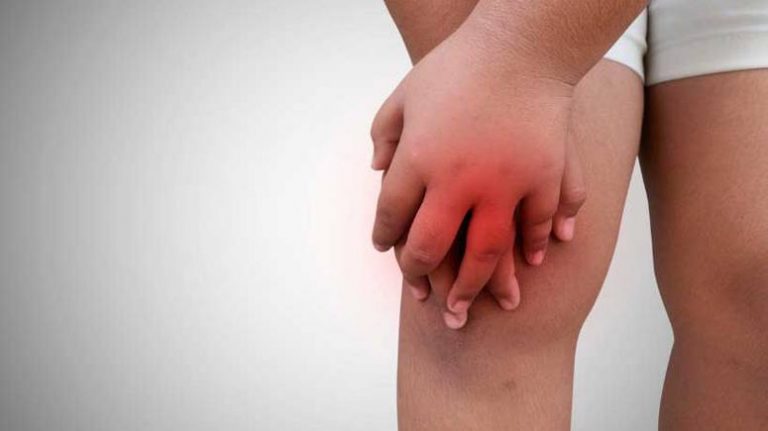 Juvenile Idiopathic Arthritis (JIA) – Types, Causes, Symptoms ...