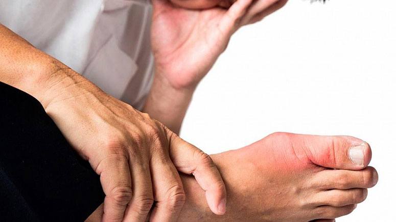Rheumatoid Arthritis in the Feet – Symptoms, Effects & Treatments ...