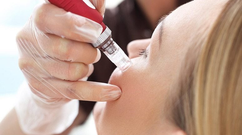 Microneedling under the Eyes: Procedure, Cost and More – Entirely Health
