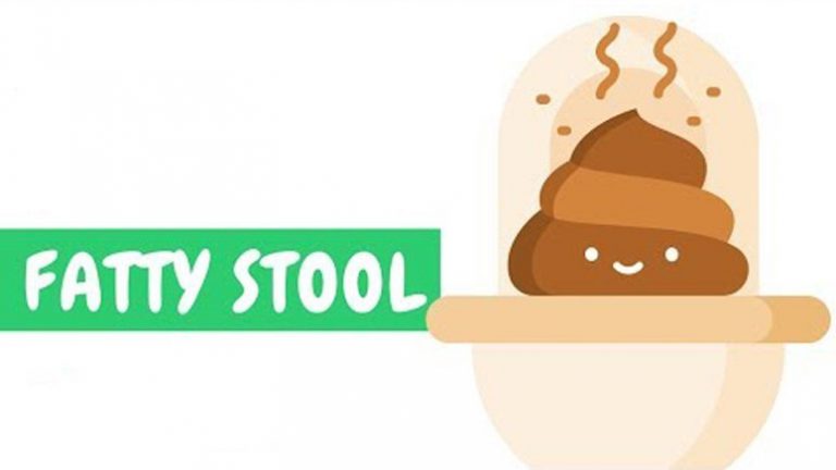Steatorrhea (Fatty Stool): All Facts To Know – Page 3 – Entirely Health