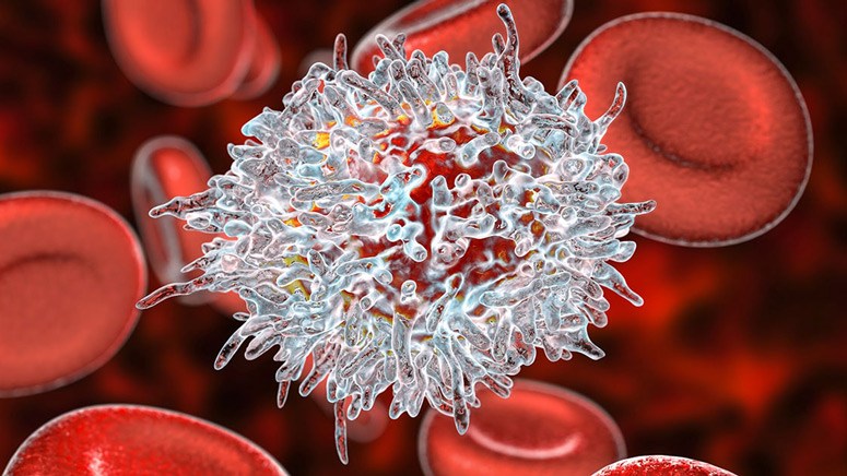 Leukemia Prevention: Tips, Facts, and More – Page 6 – Entirely Health