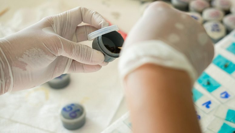 Calprotectin Stool Test: Uses and How It Works – Page 4 – Entirely Health