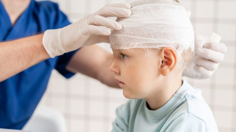 Cerebral (Brain) Atrophy – Causes, Symptoms, Diagnosis and Treatment ...