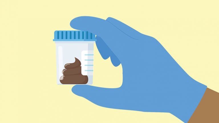 Calprotectin Stool Test: Uses and How It Works – Page 5 – Entirely Health