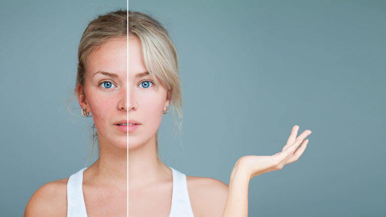 Dermaplaning: Efficacy, Side Effects and More – Page 3 – Entirely Health