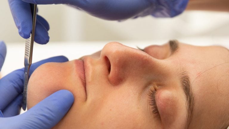 Dermaplaning: Efficacy, Side Effects and More – Entirely Health