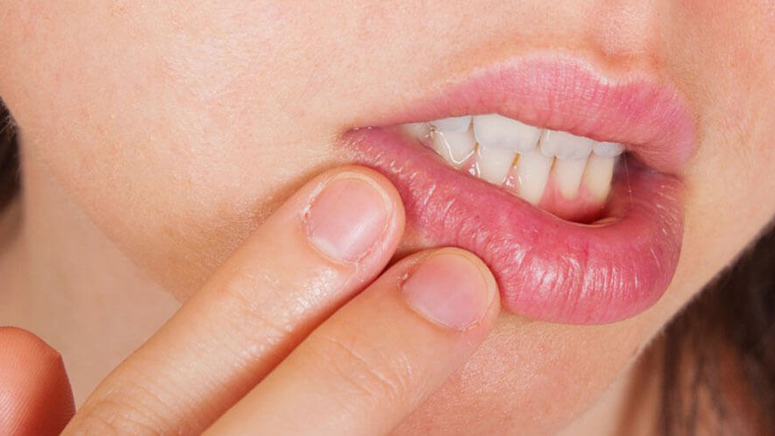 Soft Palate – What to Know – Page 5 – Entirely Health