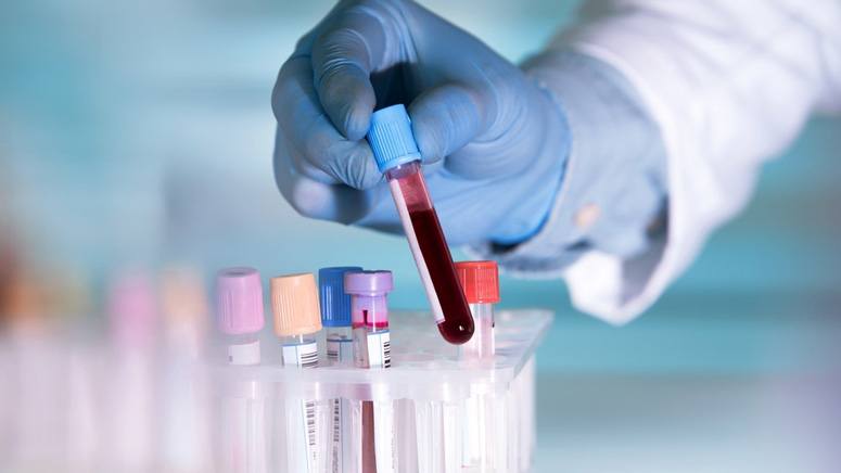 Syphilis and HIV – The Intersection of Two Epidemics – Page 6 ...