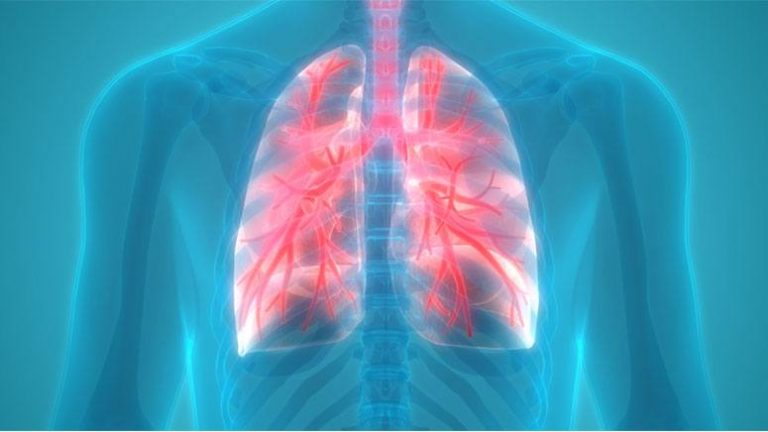 Lung Needle Biopsy – What You Need to Know – Entirely Health