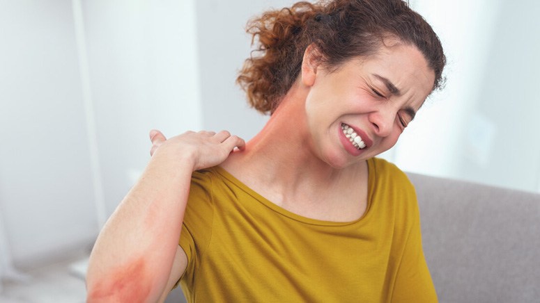 Why Does Eczema Itch? – Entirely Health