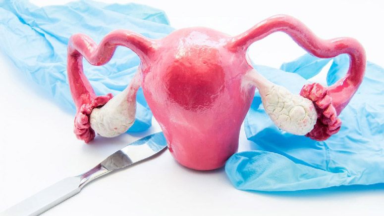 Hysterectomy Purpose Procedure Benefits Risks And Recovery Page