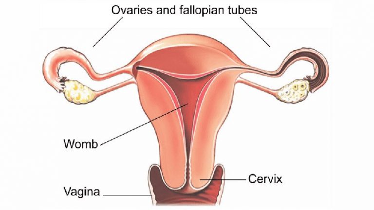 Hysterectomy Purpose Procedure Benefits Risks And Recovery