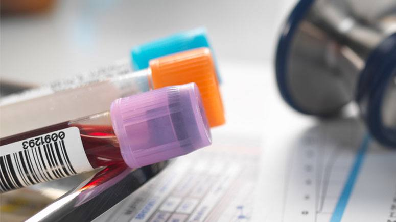 B-Type Natriuretic Peptide (BNP) Test – What to Know – Page 6 ...