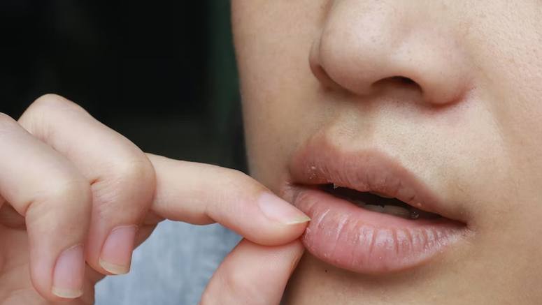 What to Do About a Scab on Your Lips – Page 5 – Entirely Health