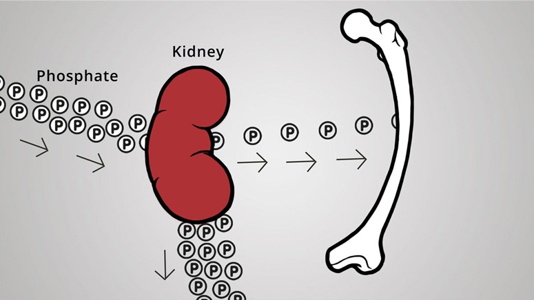 Hypophosphatemia: Symptoms, Causes, and Treatments – Page 5 – Entirely ...