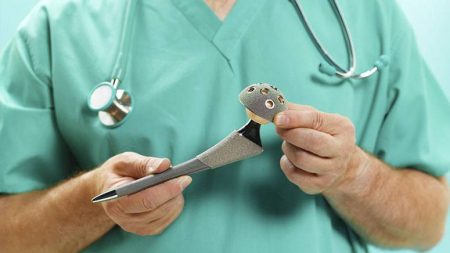 Ceramic Hip Replacement: Facts to Know – Entirely Health