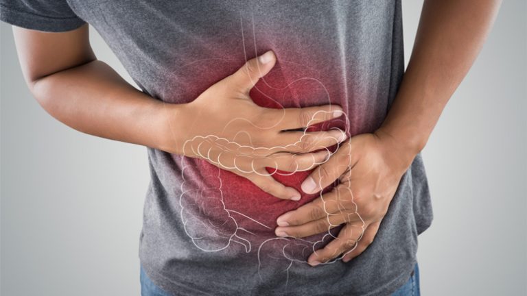 Ulcerative Colitis Diagnosis and Testing – Entirely Health
