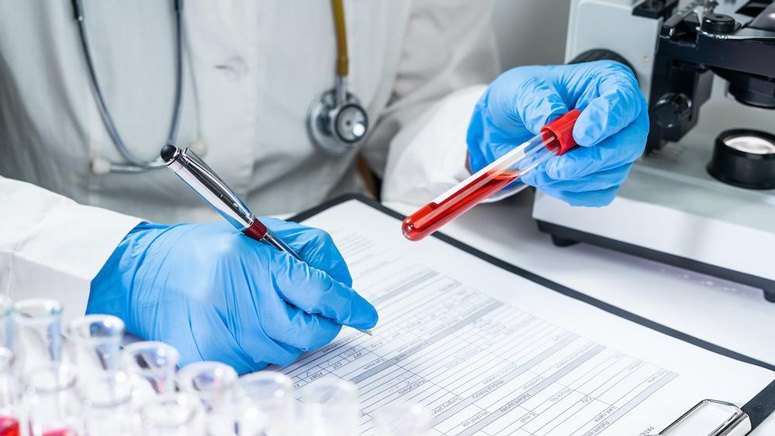 10 Common Symptoms of Low Hematocrit Level – Page 2 – Entirely Health