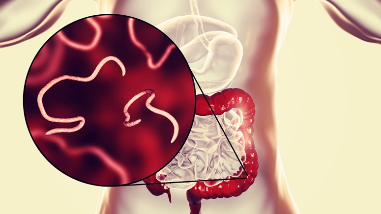 Pinworm Infection: Causes, Symptoms, Diagnosis & Treatments – Entirely ...
