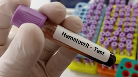 Hematocrit Test: What It Is, Levels, High & Low Rang – Entirely Health