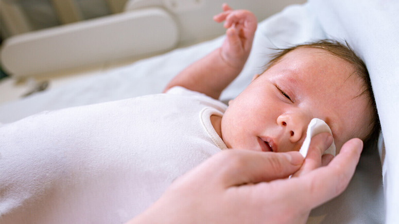 Blepharitis (Eyelid Inflammation): Causes, Diagnosis & Treatment – Page ...