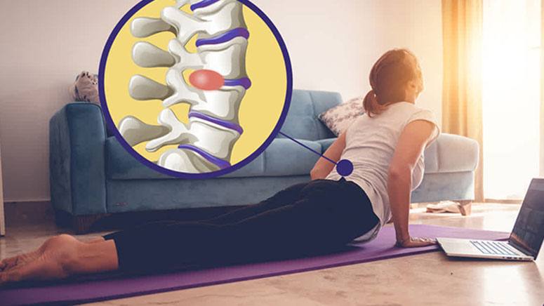 12 Causes of Bulging Discs – Page 9 – Entirely Health