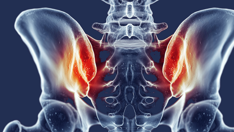 15 Common Causes of Sacroiliitis – Page 3 – Entirely Health