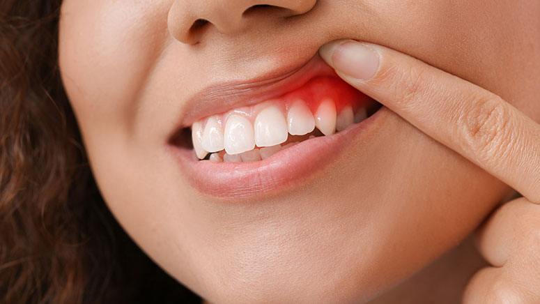 10 Possible Reasons for Your Gum Pain – Page 2 – Entirely Health