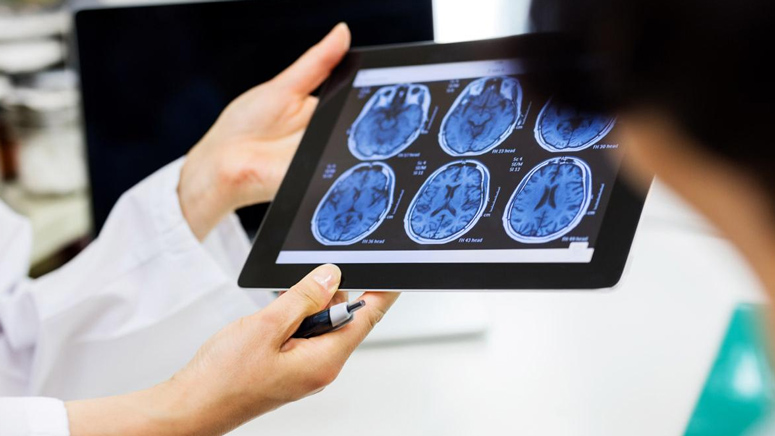 Cognitive Tests for Dementia Diagnosis – Page 8 – Entirely Health