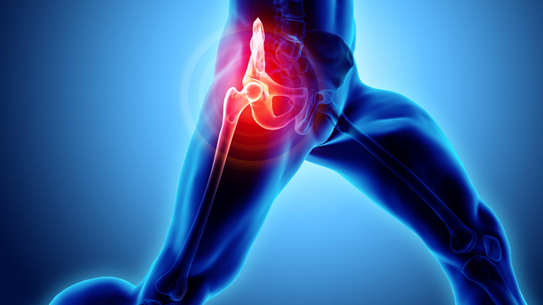 Hip Labral Tear: Symptoms, Causes, Treatments – Page 3 – Entirely Health