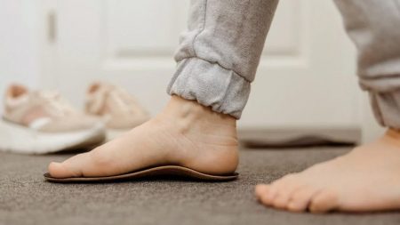 Tarsal Tunnel Syndrome: Symptoms, Causes & Treatment – Page 2 ...