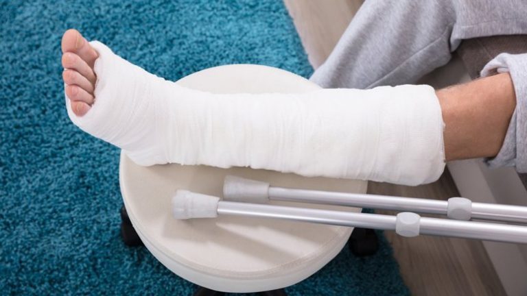Broken Foot: Symptoms & Care Instructions – Entirely Health