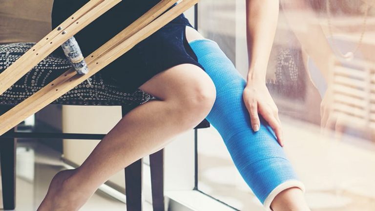 Femur Fracture: What Is It, Symptoms and Treatment – Entirely Health