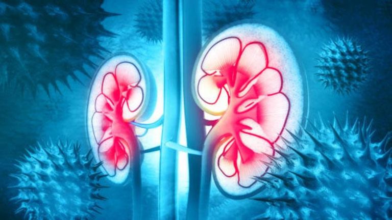 Uremia: Causes, Symptoms, Complications & Treatments – Entirely Health